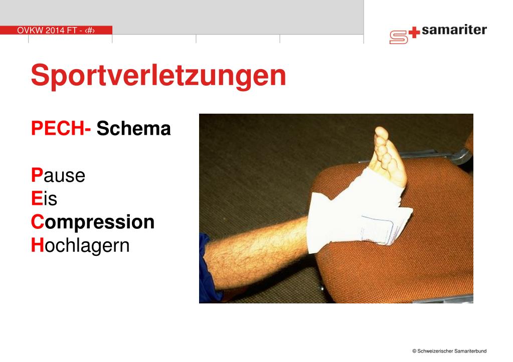 PPT - Sportverletzungen Fussgelenk-Tapeverband PowerPoint Presentation ...