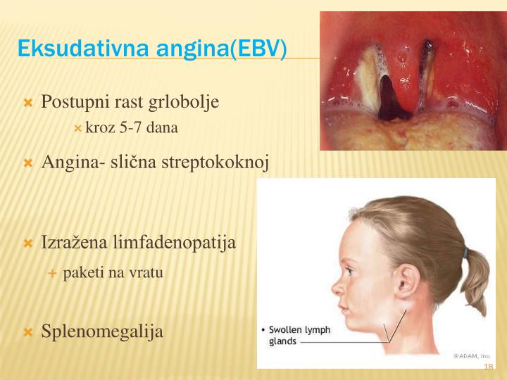PPT - ANGINE PowerPoint Presentation - ID:3794803