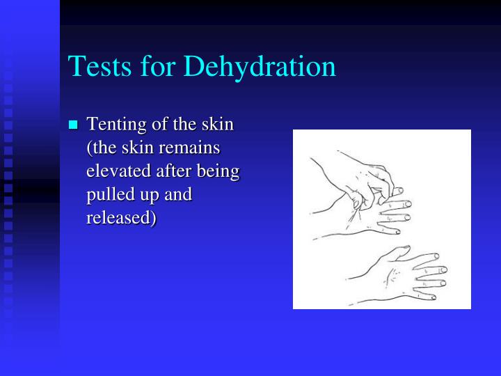 PPT - DEHYDRATION IN BOXING PowerPoint Presentation - ID:3795955
