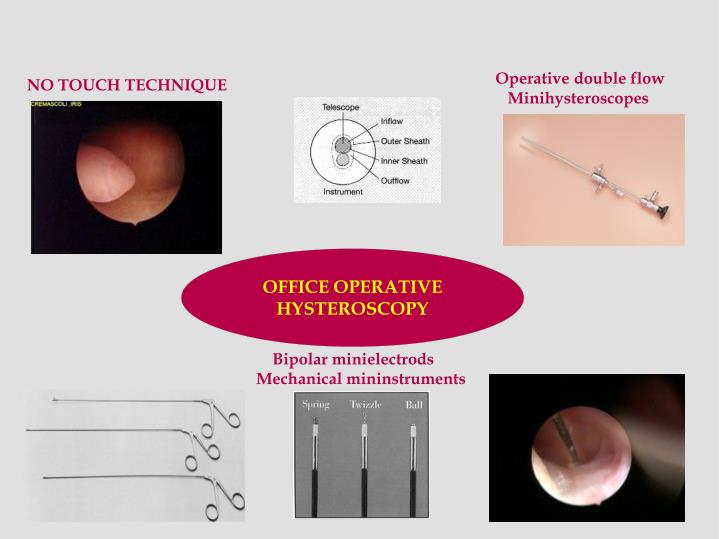 PPT - OUR EXPERIENCE IN OUTPATIENT OPERATIVE HYSTEROSCOPY PowerPoint ...