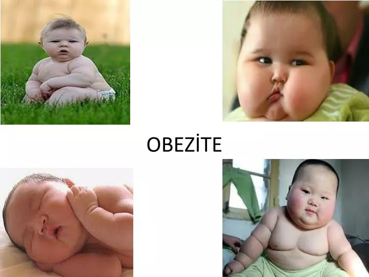 PPT - OBEZİTE PowerPoint Presentation, free download - ID:3800184