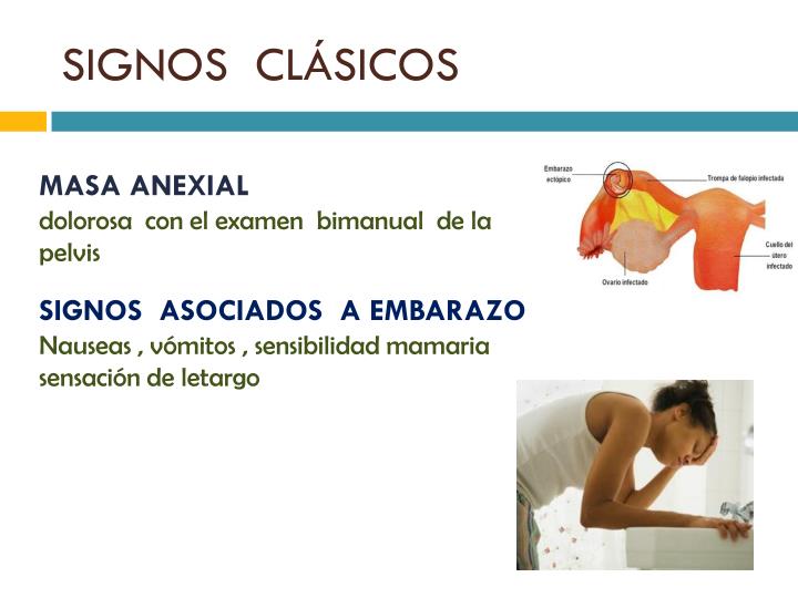 PPT - EMBARAZO ECTÓPICO PowerPoint Presentation - ID:3803128