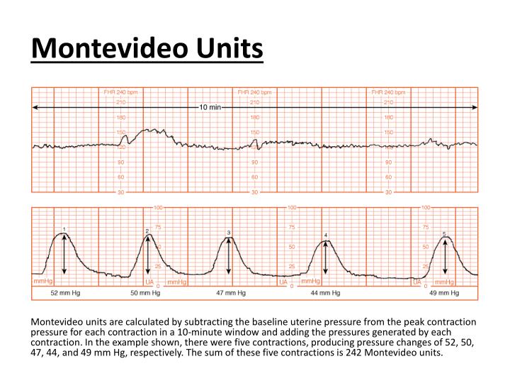 PPT - OBSTETRICS OSCE REVIEWER PowerPoint Presentation - ID:3807975