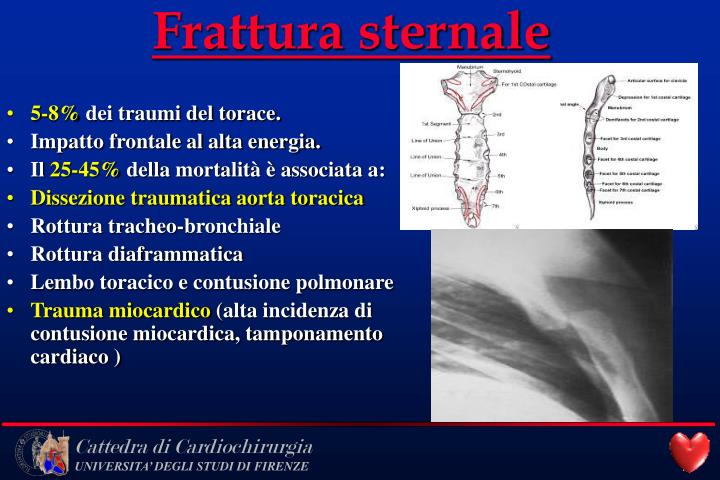 PPT - Traumatologia cardio- vascolare PowerPoint Presentation - ID:3808993