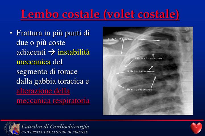 PPT - Traumatologia cardio- vascolare PowerPoint Presentation - ID:3808993