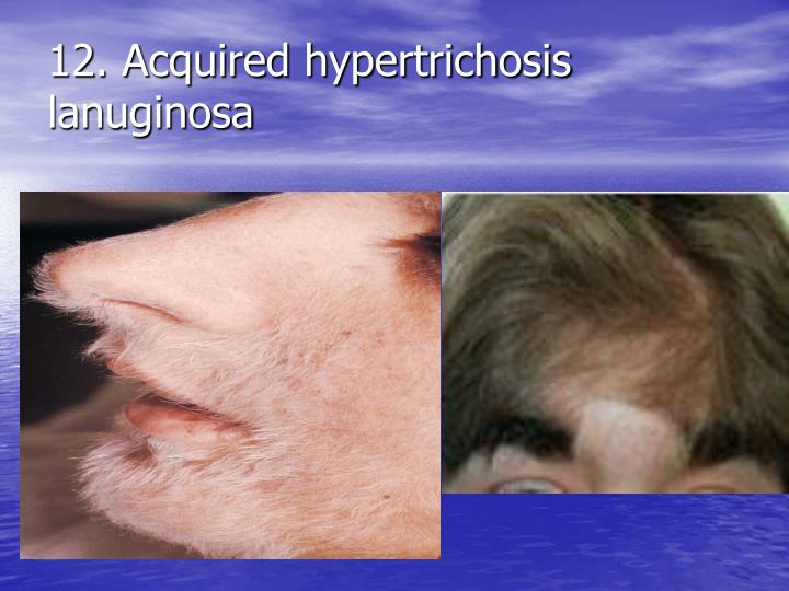 PPT - Dermatological Manifestations of Systemic Diseases PowerPoint ...
