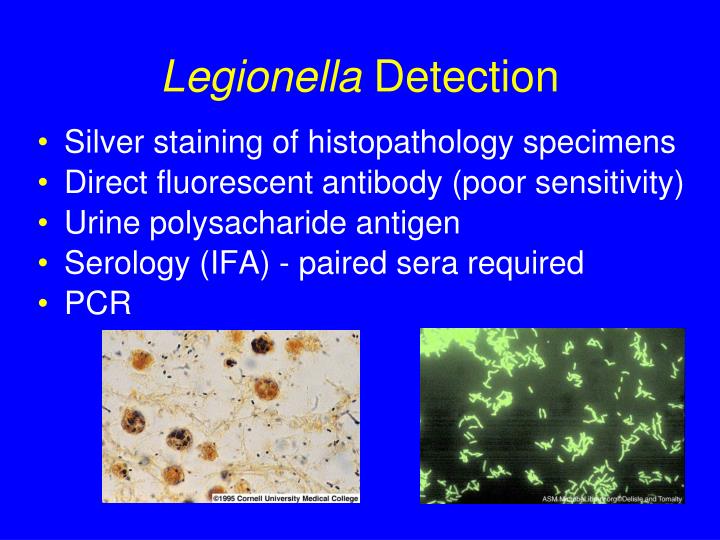 PPT - Mycoplasmas and Fastidious Gram-negative Bacteria PowerPoint ...