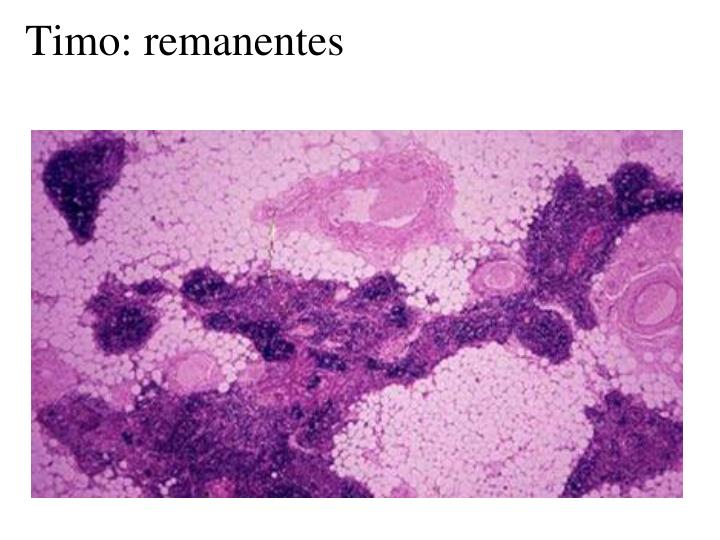 PPT - Sistema Linfático PowerPoint Presentation - ID:3819477