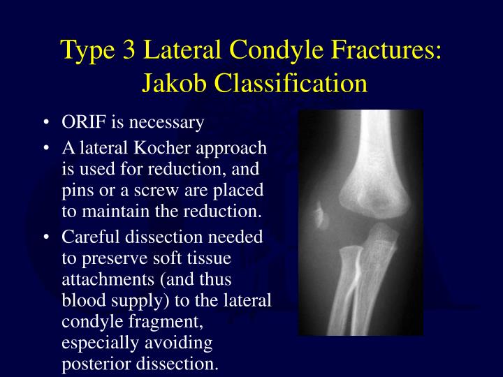 PPT - Fractures and Dislocations about the Elbow in the Pediatric ...