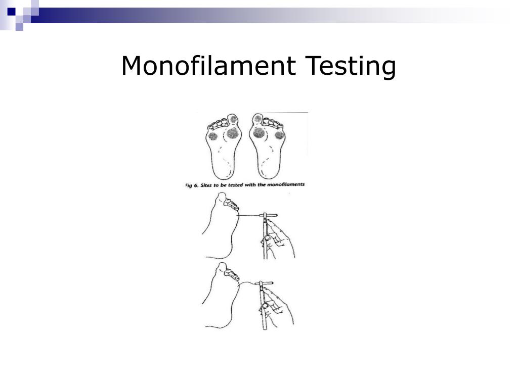 PPT - Orthotic Treatment of The Neuropathic Diabetic Foot PowerPoint ...