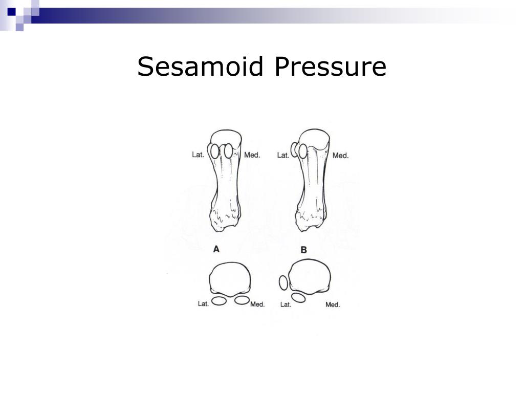 PPT - Orthotic Treatment of The Neuropathic Diabetic Foot PowerPoint ...