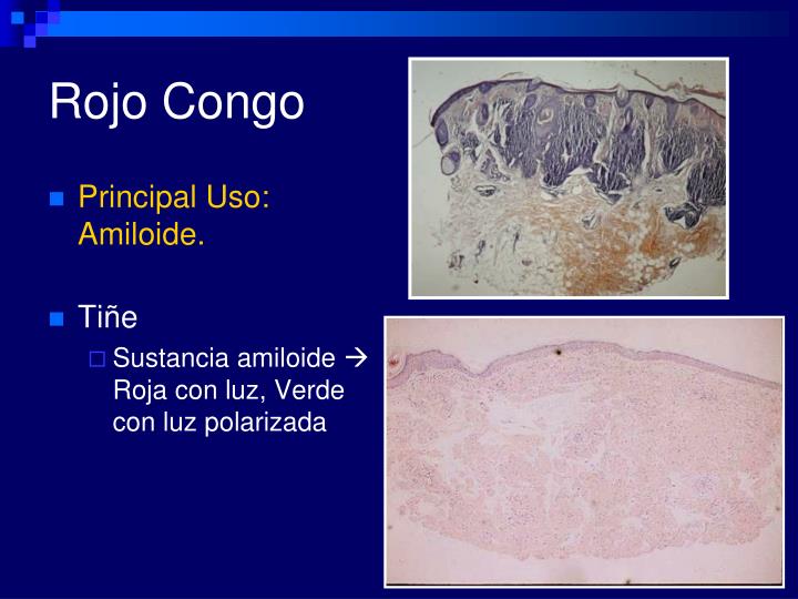 PPT - Tinción Histológica PowerPoint Presentation - ID:3822225