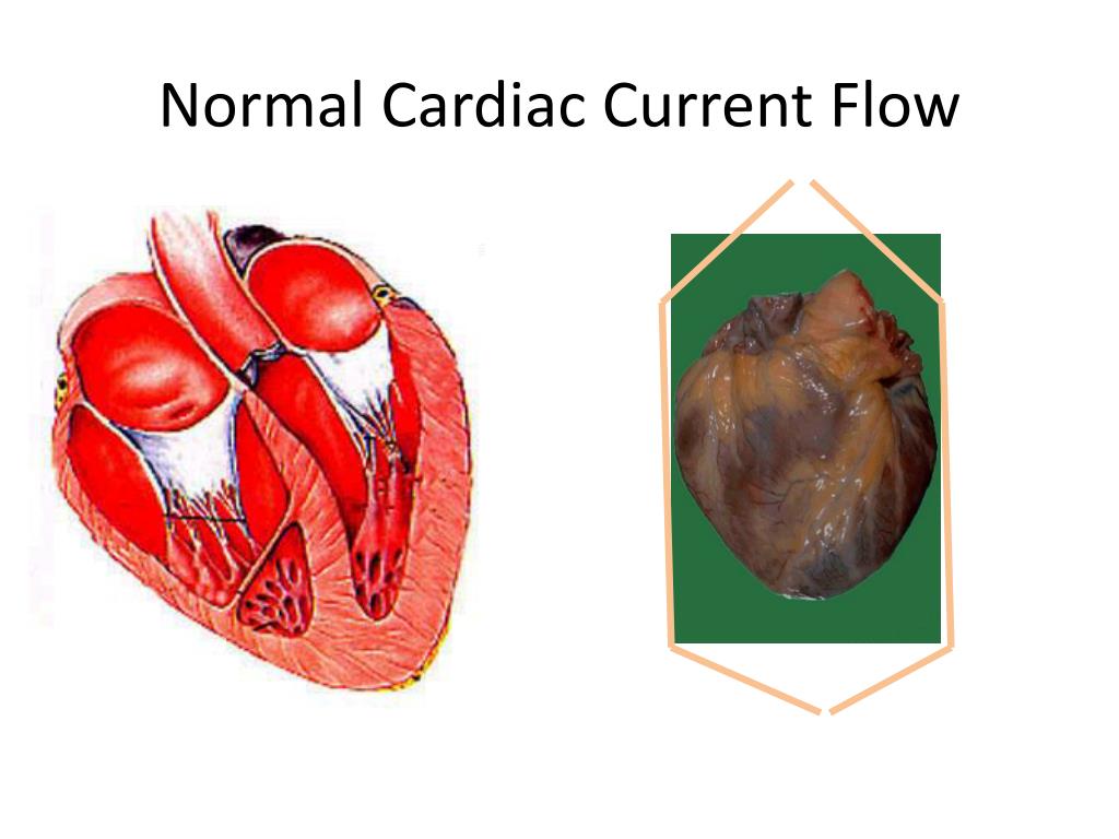 PPT - ECGG Interpretation PowerPoint Presentation, free download - ID ...