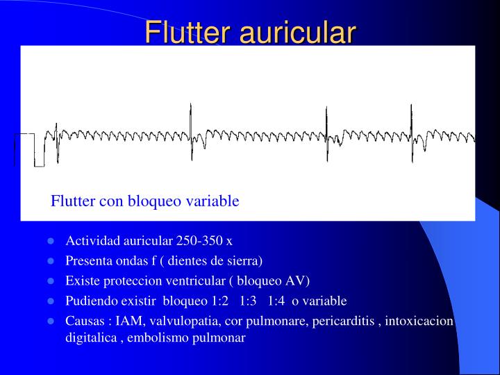 PPT - ARRITMIAS CARDIACAS PowerPoint Presentation - ID:3824403