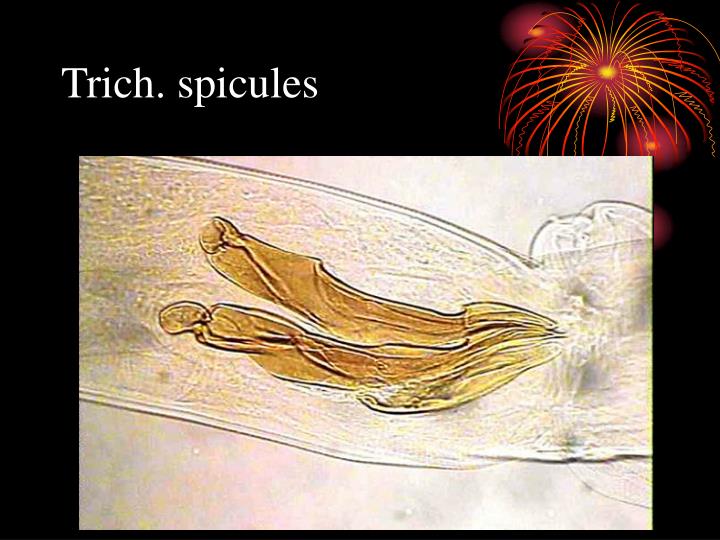 PPT - Trichostrongylus spp. PowerPoint Presentation - ID:3824497