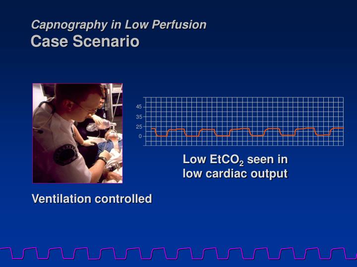 PPT - CAPNOGRAPHY In Emergency Care PowerPoint Presentation - ID:3826595