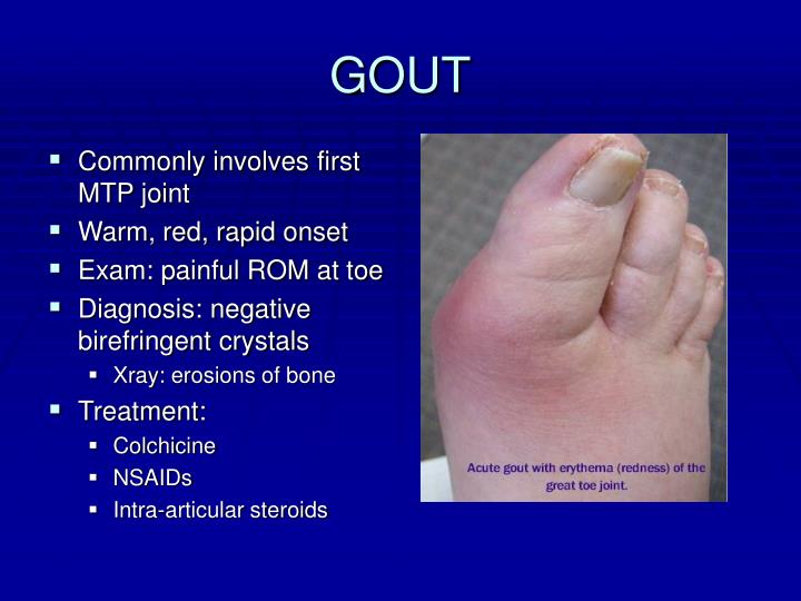 PPT - Foot and Ankle Complaints PowerPoint Presentation - ID:3830350