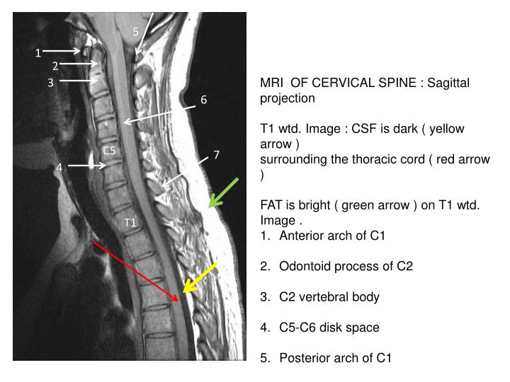 PPT - MRI of the Thoracic Spine: Axial T1 wtd.images. PowerPoint ...