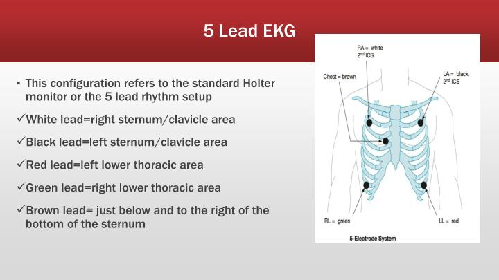 PPT - EKG PowerPoint Presentation - ID:3835591