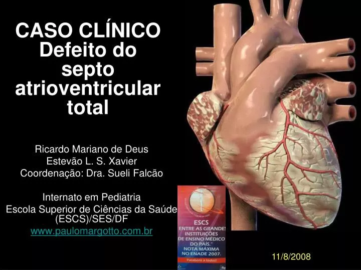 PPT - CASO CLÍNICO Defeito do septo atrioventricular total PowerPoint ... PPT - CASO CLÍNICO Defeito do septo atrioventricular total PowerPoint ...