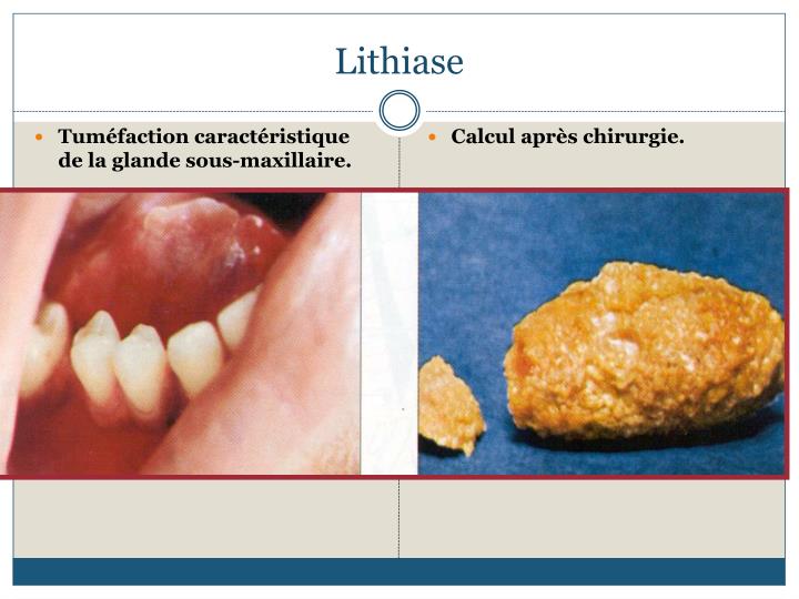 PPT - Maladies des glandes salivaires PowerPoint Presentation - ID:3837983
