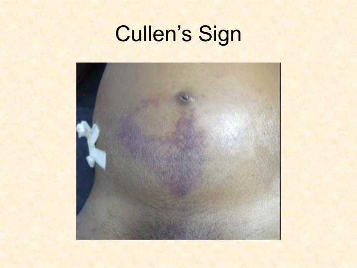 PPT - Acute Pancreatitis PowerPoint Presentation - ID:3839247