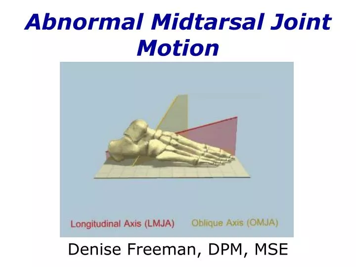 PPT - Abnormal Midtarsal Joint Motion PowerPoint Presentation, free ...
