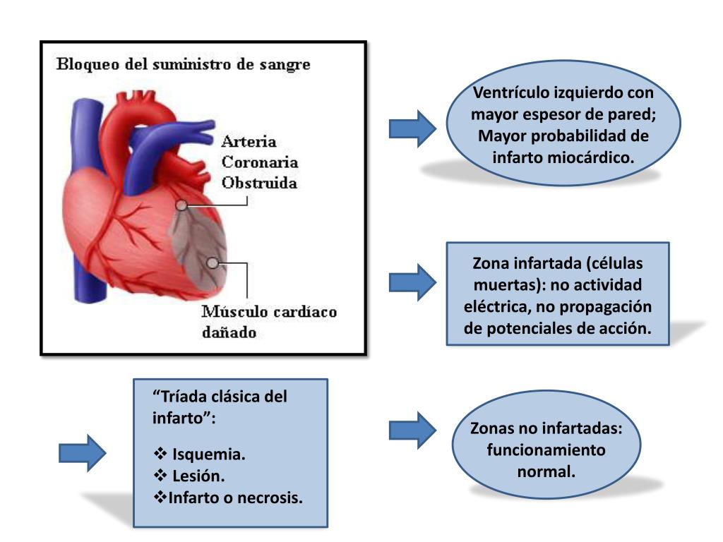 PPT - Por Melanie Cobos, Lucía Fernández y Germán Huerga . PowerPoint ...