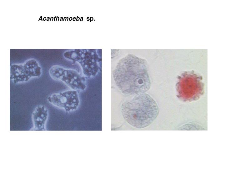 PPT - Amebas de Vida Livre PowerPoint Presentation - ID:3841072