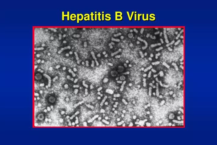 PPT - Hepatitis B Virus PowerPoint Presentation, free download - ID:3842468