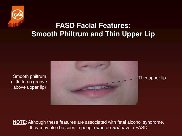 PPT - FASD PowerPoint Presentation - ID:3845330