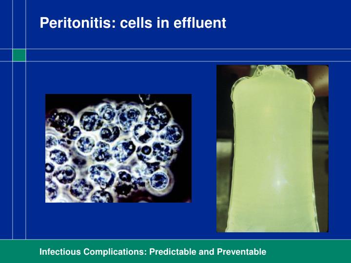 PPT - Infections in PD Prevention and Management PowerPoint ...