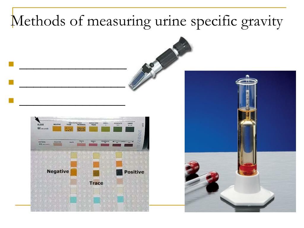 Urine Specific Gravity Chart Urine Specific Gravity Chart