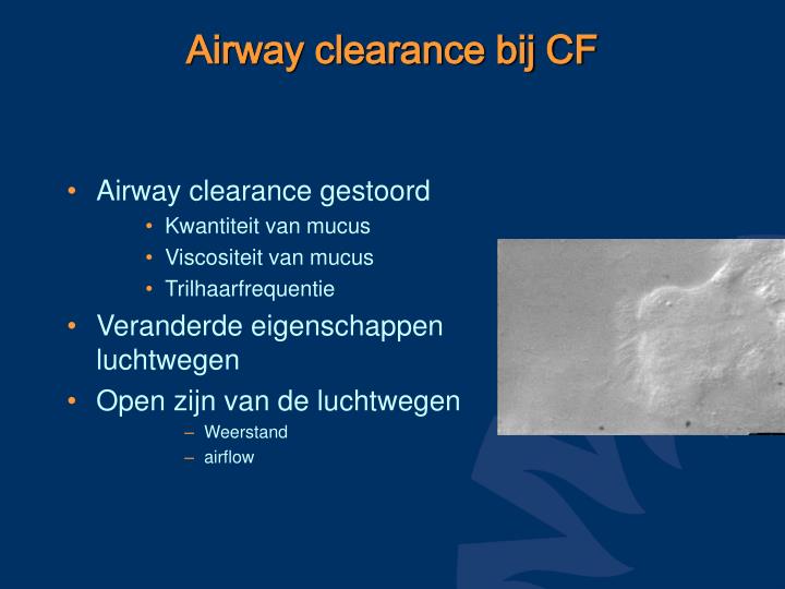 PPT - Airway Clearance Therapy bij Cystic Fibrosis? PowerPoint ...