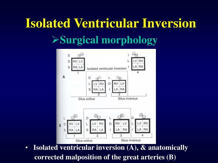 PPT - Corrected Transposition of Great Arteries PowerPoint Presentation ...