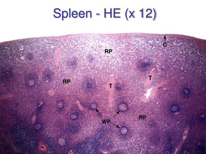 PPT - Spleen and thymus PowerPoint Presentation - ID:3875884