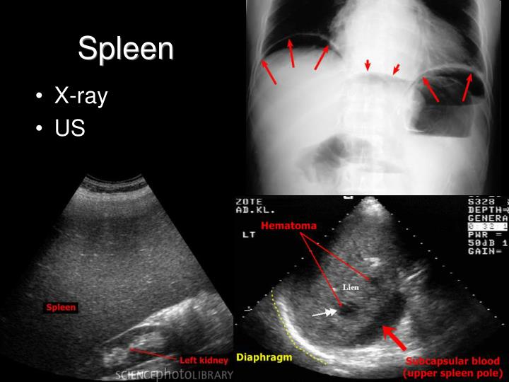 PPT - Spleen and thymus PowerPoint Presentation - ID:3875884