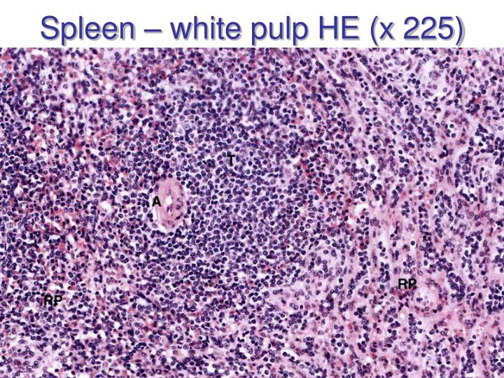 PPT - Spleen and thymus PowerPoint Presentation - ID:3875884