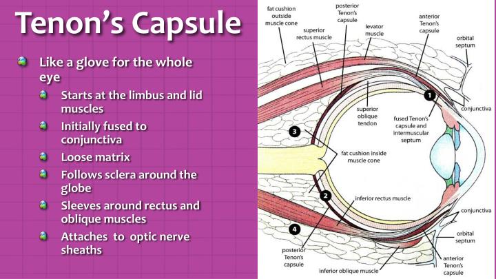 PPT - Anterior Sub- Tenon’s Anaesthesia (ASTA) for Cataract Surgery ...