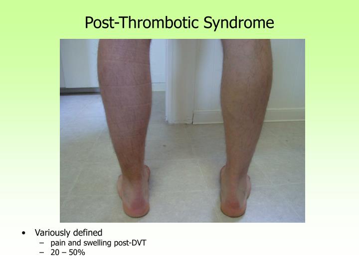 PPT - Venothrombotic Disease & Urological Surgery PowerPoint ...