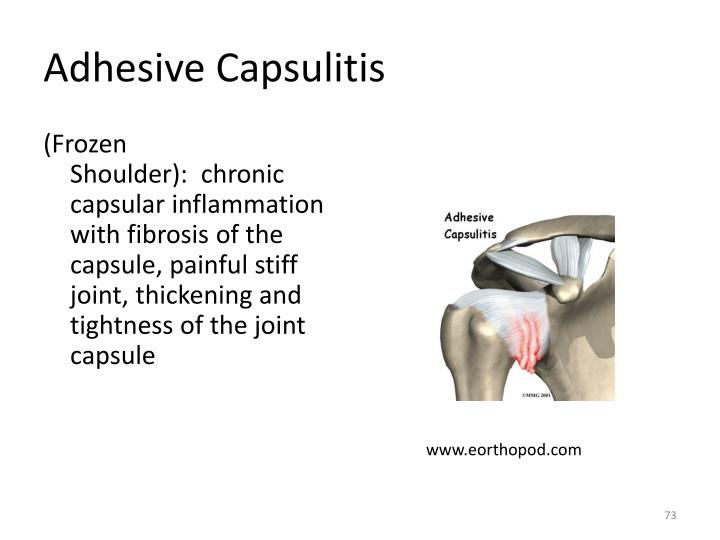 PPT - Shoulder Girdle Pathology PowerPoint Presentation - ID:3882186