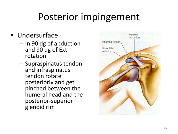 PPT - Shoulder Girdle Pathology PowerPoint Presentation - ID:3882186
