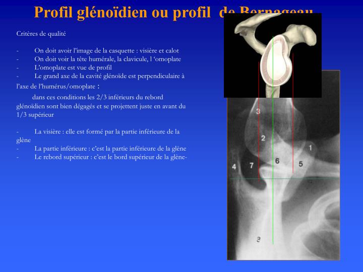 PPT - ANATOMIE RADIOLOGIQUE DE L’EPAULE PowerPoint Presentation - ID ...