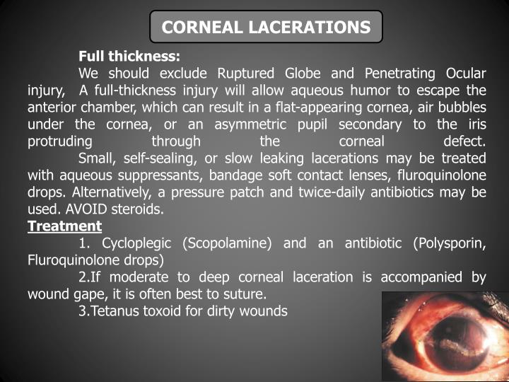 PPT - OCULAR TRAUMA. DIAGNOSIS AND TREATMENT. PowerPoint Presentation ...