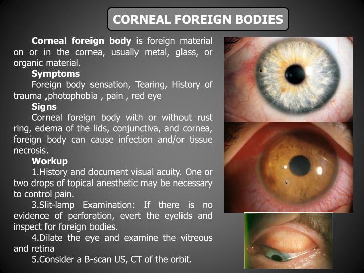 PPT - OCULAR TRAUMA. DIAGNOSIS AND TREATMENT. PowerPoint Presentation ...