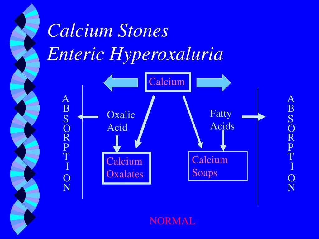 Ppt Nephrolithiasis Powerpoint Presentation Free Download Id 3891779