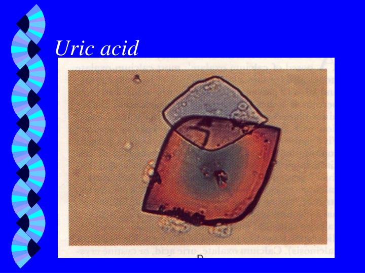 PPT - Nephrolithiasis PowerPoint Presentation - ID:3891779