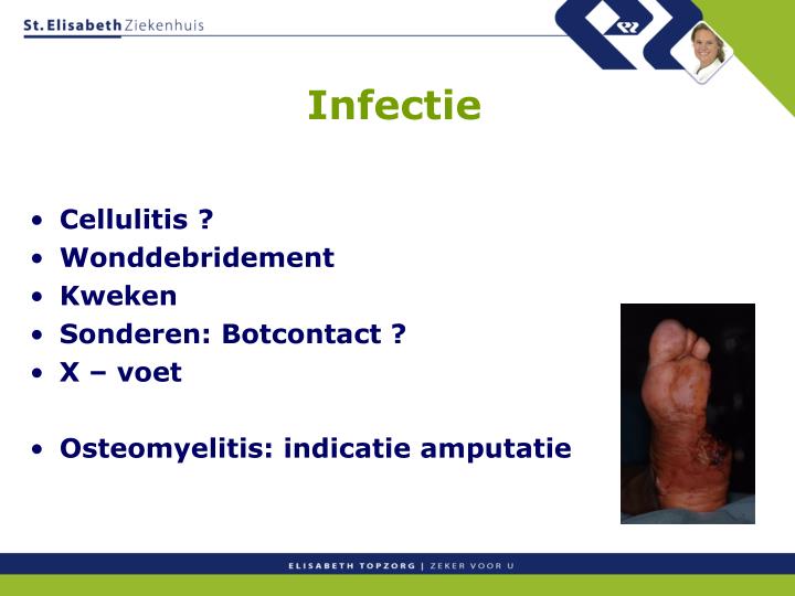 PPT - Diabetische voet Pathofysiologie, diagnostiek en behandeling ...