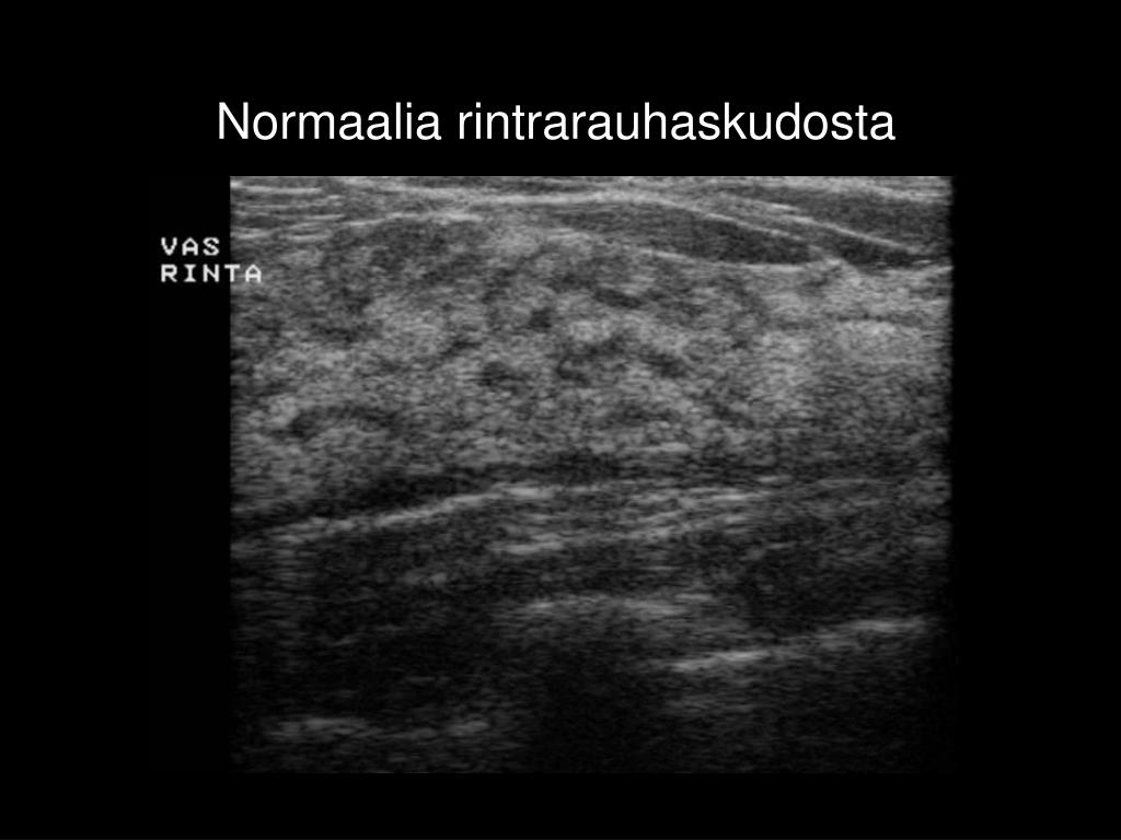 PPT - Radiologin tekemät UÄ-tutkimukset PowerPoint Presentation, free ...