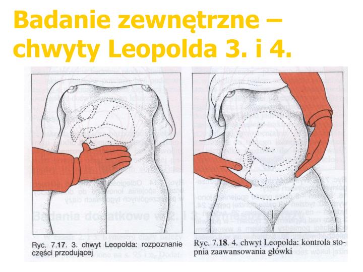 PPT - Poród patologiczny PowerPoint Presentation - ID:3903147